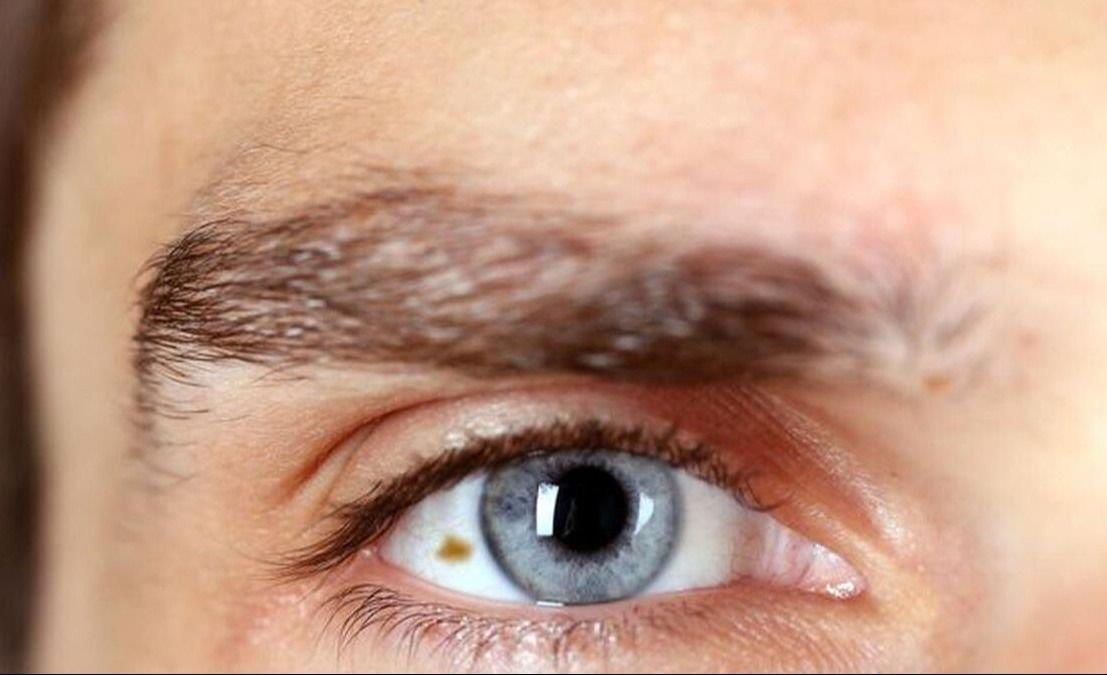 Qué es el cáncer de ojo: Síntomas, causas y tratamiento - Ciudadano News